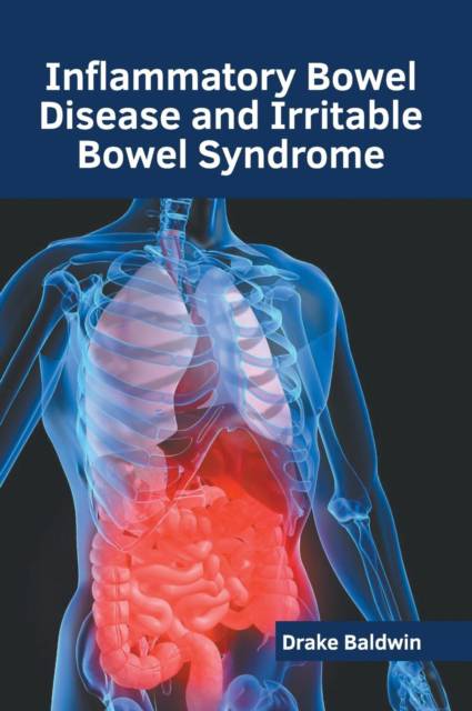 Inflammatory Bowel Disease and Irritable Bowel Syndrome ...