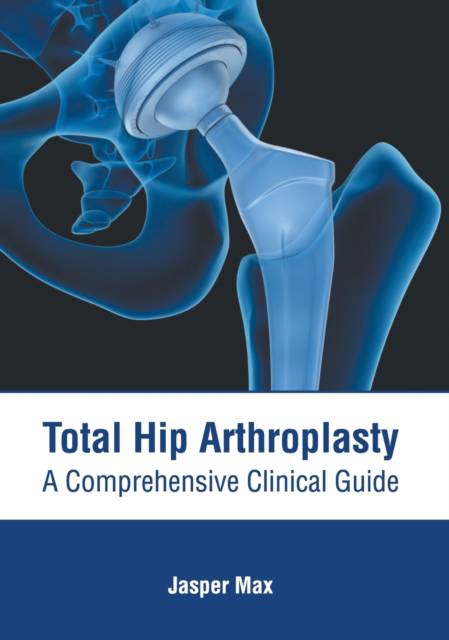 Total Hip Arthroplasty: A Comprehensive Clinical Guide | | Spécialisations | 9781639274048 ...